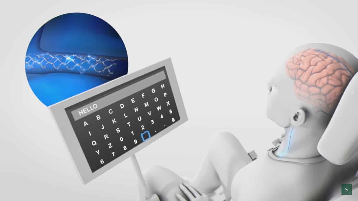 Chip implantado no cérebro é capaz de ler pensamentos - Olhar Digital