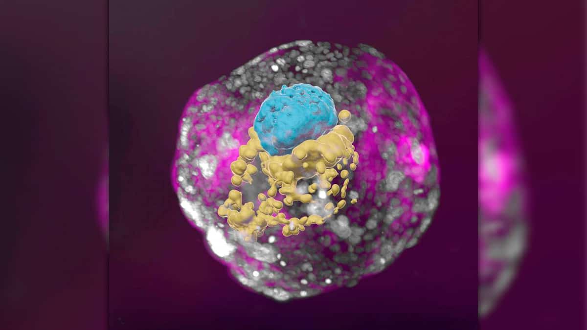 Cientistas criam 1º modelo de embrião humano com células-tronco