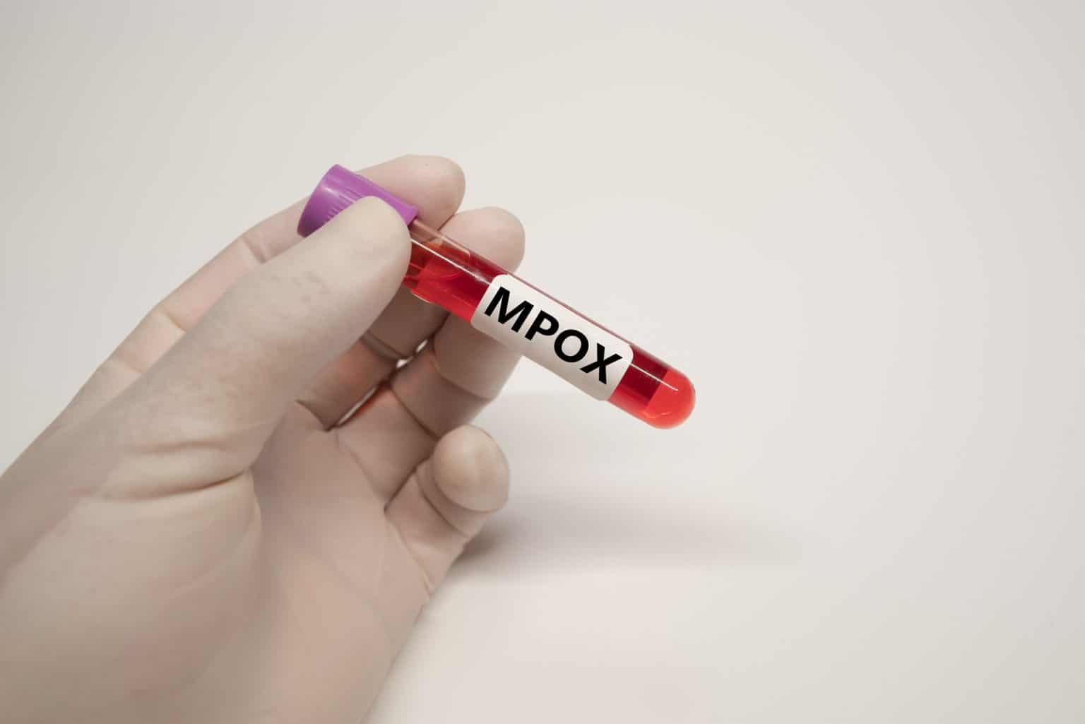 O que é mpox e por que ela está se espalhando tão rápido? - Olhar Digital