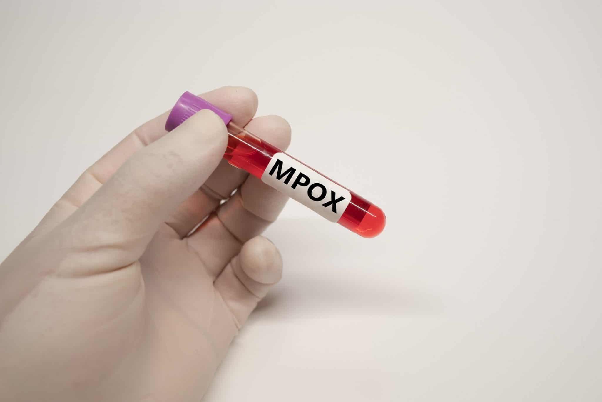 Mpox: saiba o que é, sintomas, prevenção e estratégia de vacinação