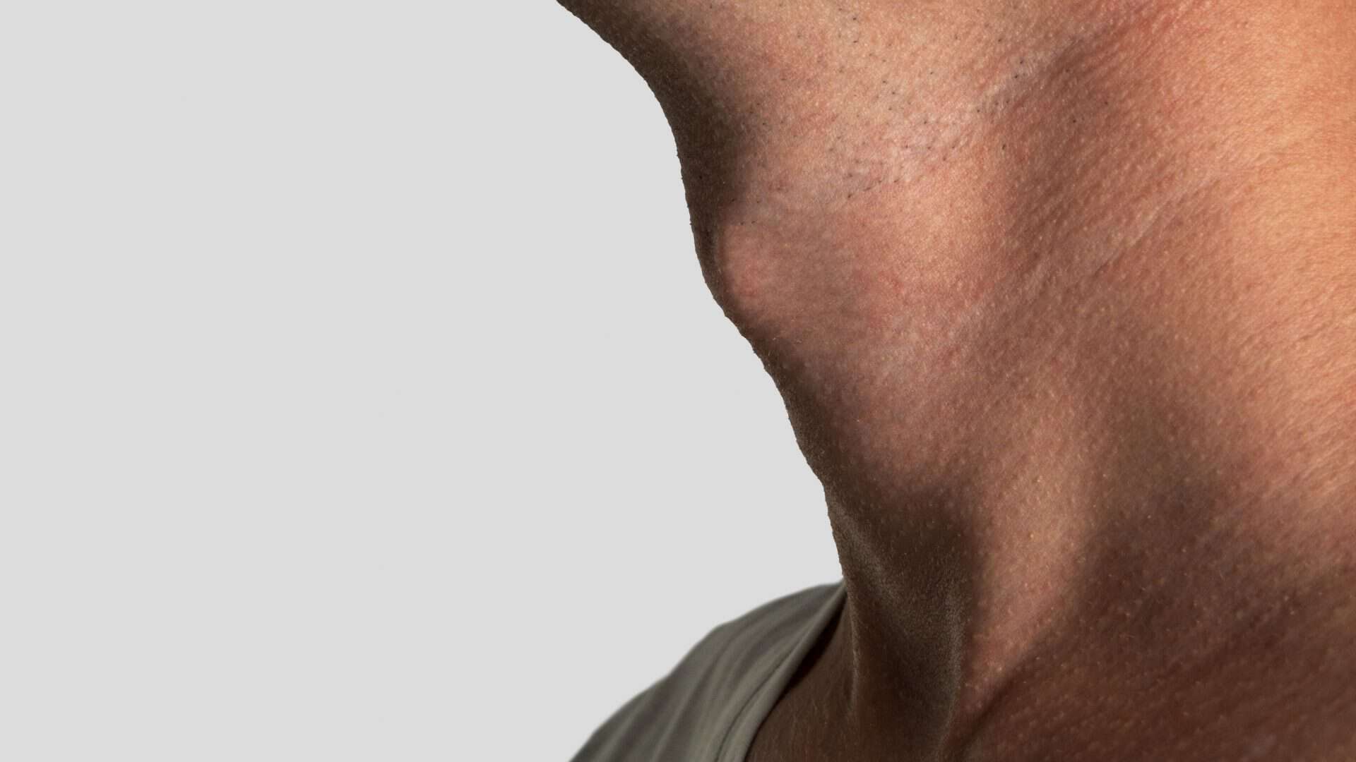 Pomo de Adão: o que é e por que os homens têm 'gogó'? - Olhar Digital